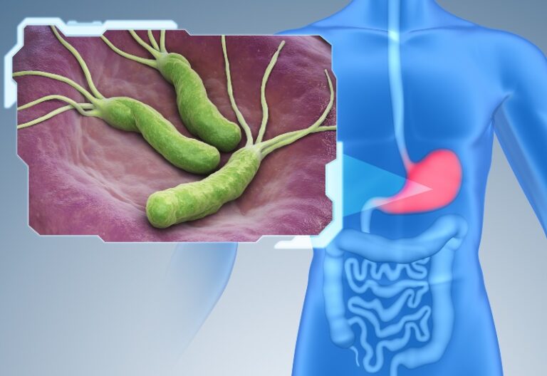 Helicobacter Pylori Treatment in Atlanta, GA